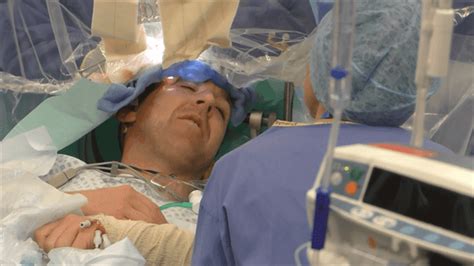AWAKE CRANIOTOMY Anesthesia Optimal Solutions