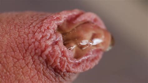 Closeup Of Uncut Cock Pissing 日本語で