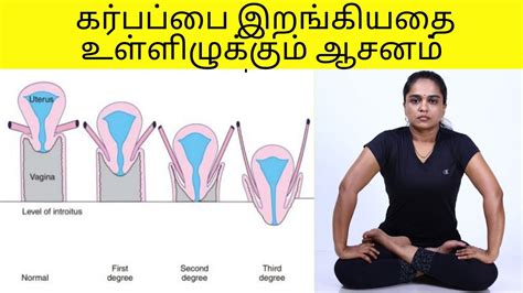 Cure for Uterus problem Yoga For Uterus Prolapse கரபபப