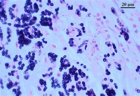 Yeast And Fungi Pictures Flashcards Quizlet