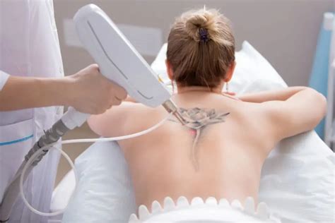 Quiero eliminar un tatuaje Cuántas sesiones necesito CENTROS BLINK
