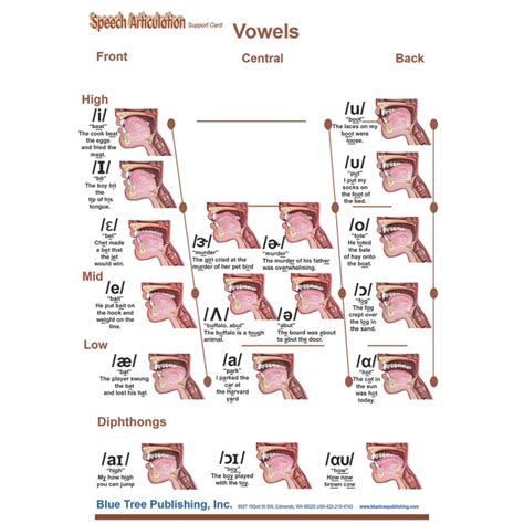 Speech Articulation Software With Charts Set