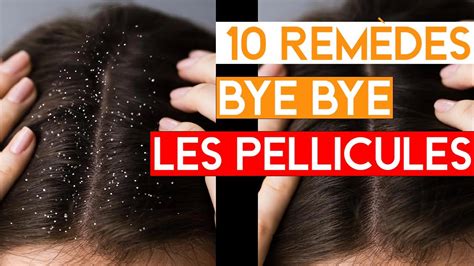 COMMENT NE PLUS AVOIR DES PELLICULES DANS LES CHEVEUX 10 REMÈDES