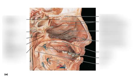 Cadaver Pt Diagram Quizlet