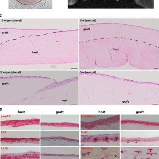 Ex Vivo Transplantation Of Decellularized Human Cornea DHC A
