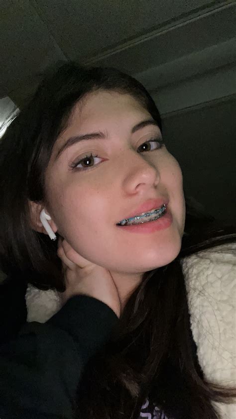 Pin By Thy Leapheng On Brace Cute Braces Brace Face Braces Smile
