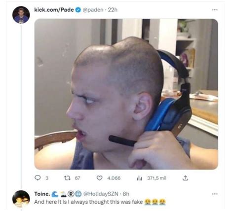 Streamer En TWITCH Se Rasura La Cabeza En Vivo Y Se Encuentra Hendidura