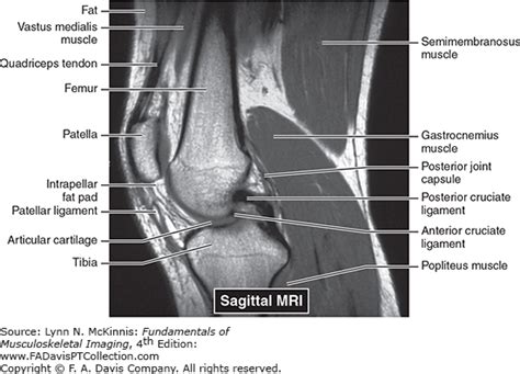Knee Mri Anatomy Radiology