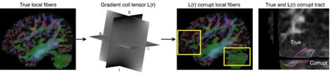 mapping the impact of approximate gradient nonlinearity fields correction on tractography