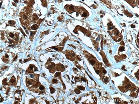 NOB1 Mouse anti Human Clone 8C11A12 Proteintech 20 μL Unconjugated