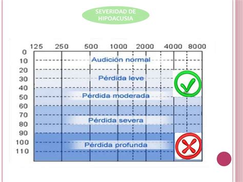 PPT HIPOACUSIA SÚBITA SENSORINEURAL IDIOPÁTICA PowerPoint