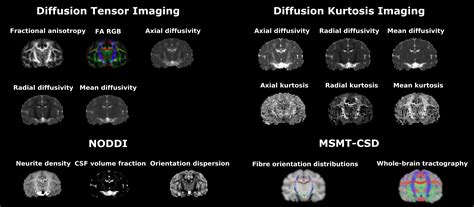 diffusion mri