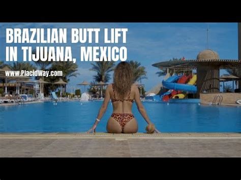 Brazilian Butt Lift In Tijuana Mexico YouTube