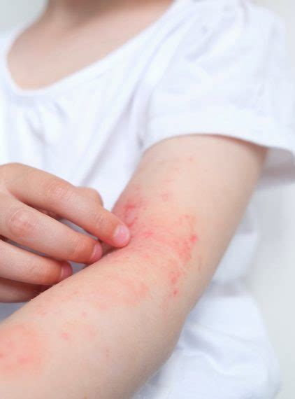 Dermatologia Poradnik Gemini