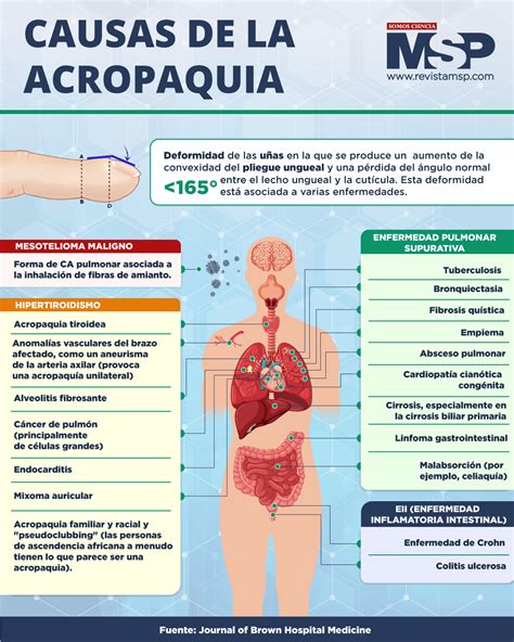 Causas De La Acropaquia