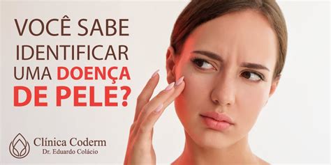 Doenças de pele a sua é perigosa Clínica Coderm