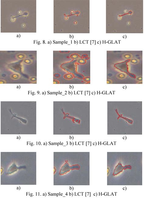 figure 11 from optimization of overlapping dendritic cell segmentation in phase contrast