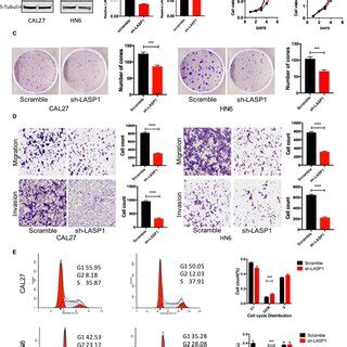The Knockdown Of LASP1 In HNSCC Cells Inhibits Cell Proliferation