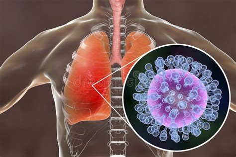 Anatomie De Virus De Grippe De Grippe Illustration Stock Illustration