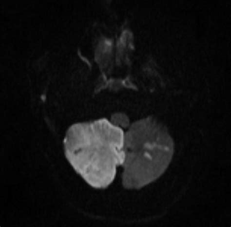 Case Of The Week Radiology Case Cafe