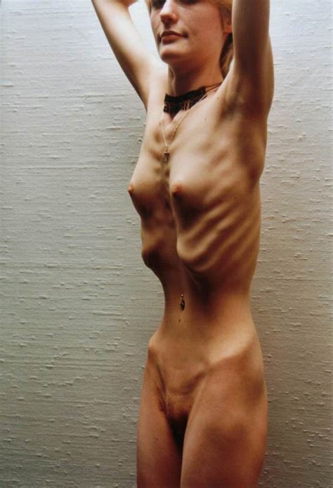 Super Skinny Anorexic Nude Xsexpics