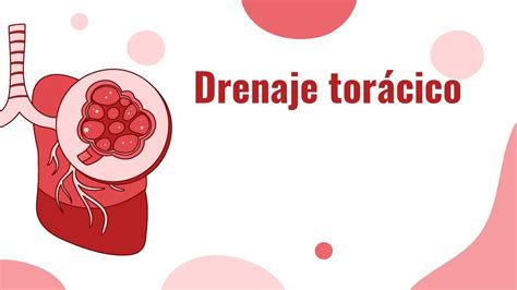 Resúmenes de Drenaje pleural Descarga apuntes de Drenaje pleural