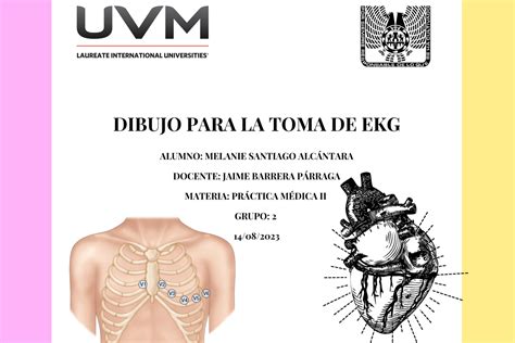 Dibujo Para La Toma De Ekg Dibujo Para La Toma De Ekg Alumno Melanie