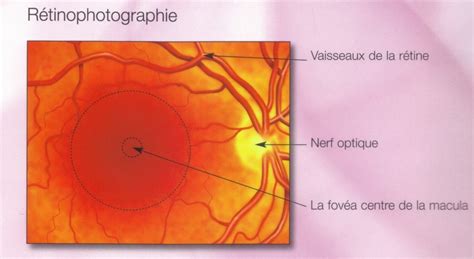 Pathologies Oculaires Centre Ophtalmologique Rabelais