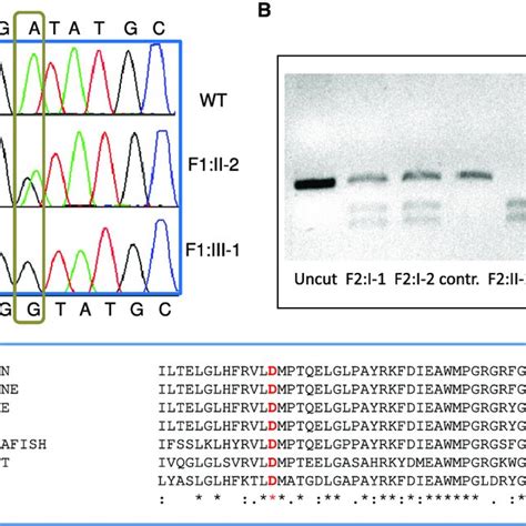 Mutation Analysis Of DNA Samples From Patients Carriers And Normal