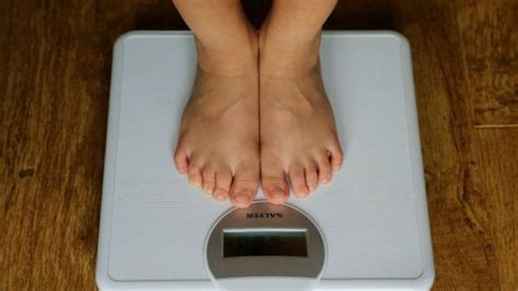 Obesidade pode afetar metade das crianças e adolescentes brasileiros