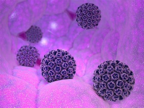 INFLUENCIA DEL VPH EN EL DESARROLLO DEL CÁNCER GINECOLÓGICO Médica La