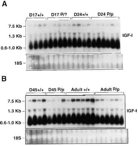 Northern Blot Hybridization Analysis Of The Hepatic IGF I MRNA In