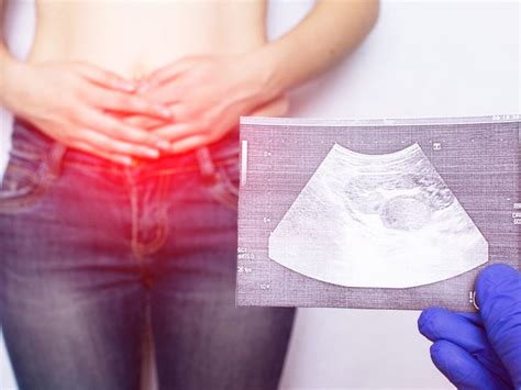Epigastric Hernia Symptoms Causes Diagnosis And Treatment OnlyMyHealth