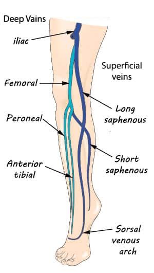 Varicose Veins Symptoms Causes And Treatments MedFog