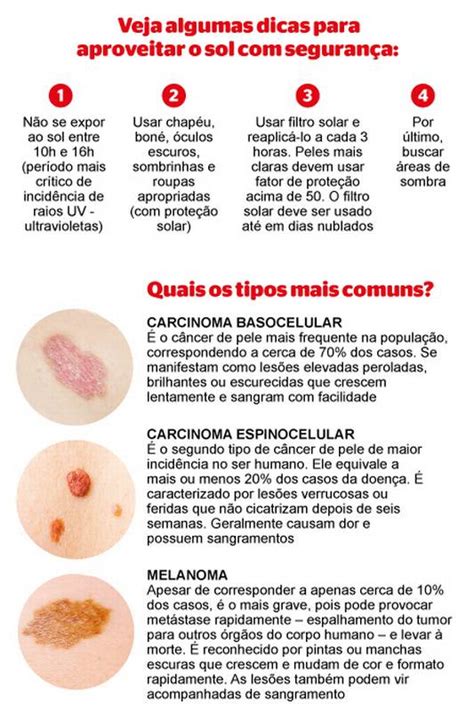 CÂNCER DE PELE INÍCIO MEU CASO REAL Muito Diva
