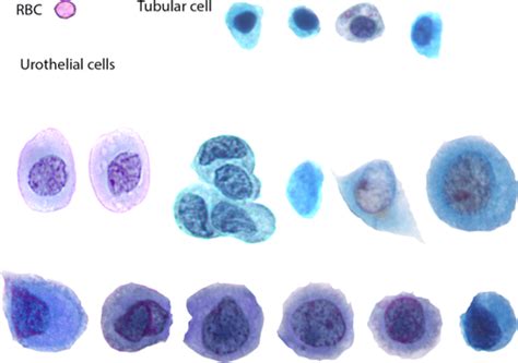 Lrctc Cytology