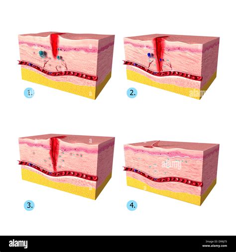 Anatomía de la reparación tisular en la piel humana Fotografía de stock