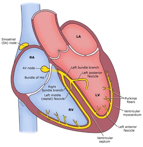 Left Bundle Branch Block Diagram
