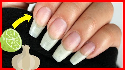 Descubrir 85 imagen receta para que crezcan las uñas Abzlocal mx