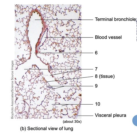 Sectional View Of Lung Histology Diagram Quizlet