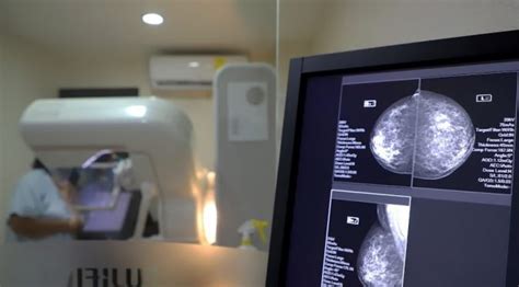 SALUD Realizadas más de 22 mil mastografías en 2024 SSM