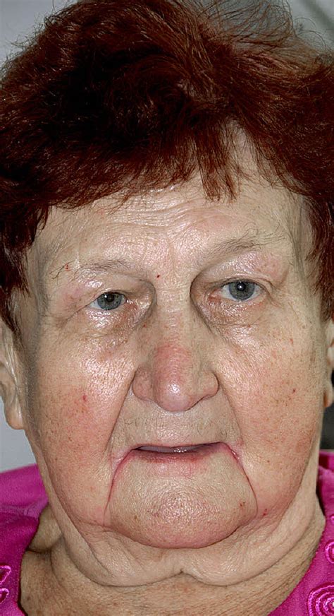 Elsa Geneu Jahre Alt Endingen Badische Zeitung