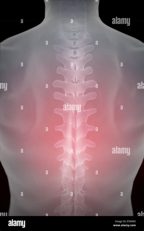 Anatomy Of Lumbar Spine High Resolution Stock Photography And Images
