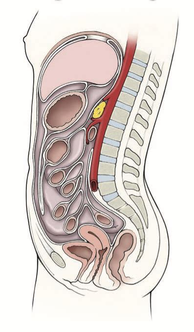 Median Section Of Peritoneum And Peritoneal Cavity Dissector Diagram