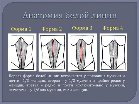 Можно ли избавиться от грыжи белой линии живота без операции фото