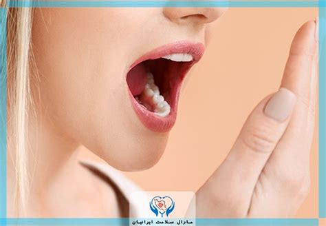 چه چیزی باعث بوی بد دهان هالیتوزیس می شود کلینیک مارال سلامت ایرانیان