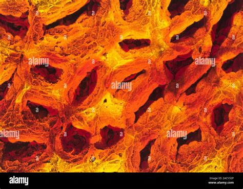 Stomach Lining Coloured Scanning Electron Micrograph A Section Through