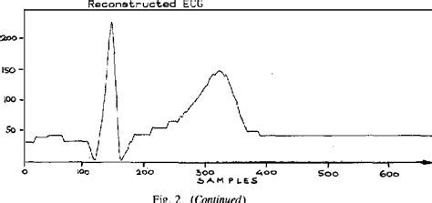 figure 2 from an adaptive real time ecg compression algorithm with variable threshold semantic