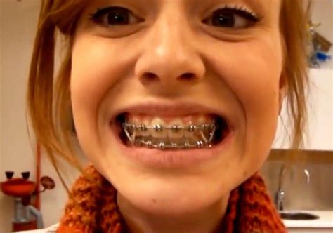 Nothing Makes Me Happier Than Seeing Braces Get Drenched Scrolller
