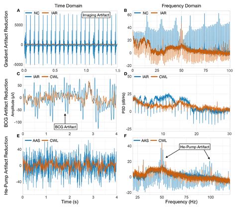 frontiers evaluation and comparison of most prevalent artifact reduction methods for eeg